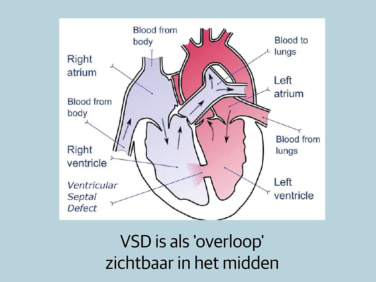 Hartproblemen bij honden: welke zijn er? | AniCura Nederland